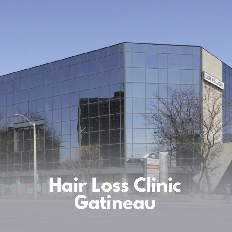 Hair Loss Clinic Gatineau- Hair loss Treatments near Gatineau - Medi ...