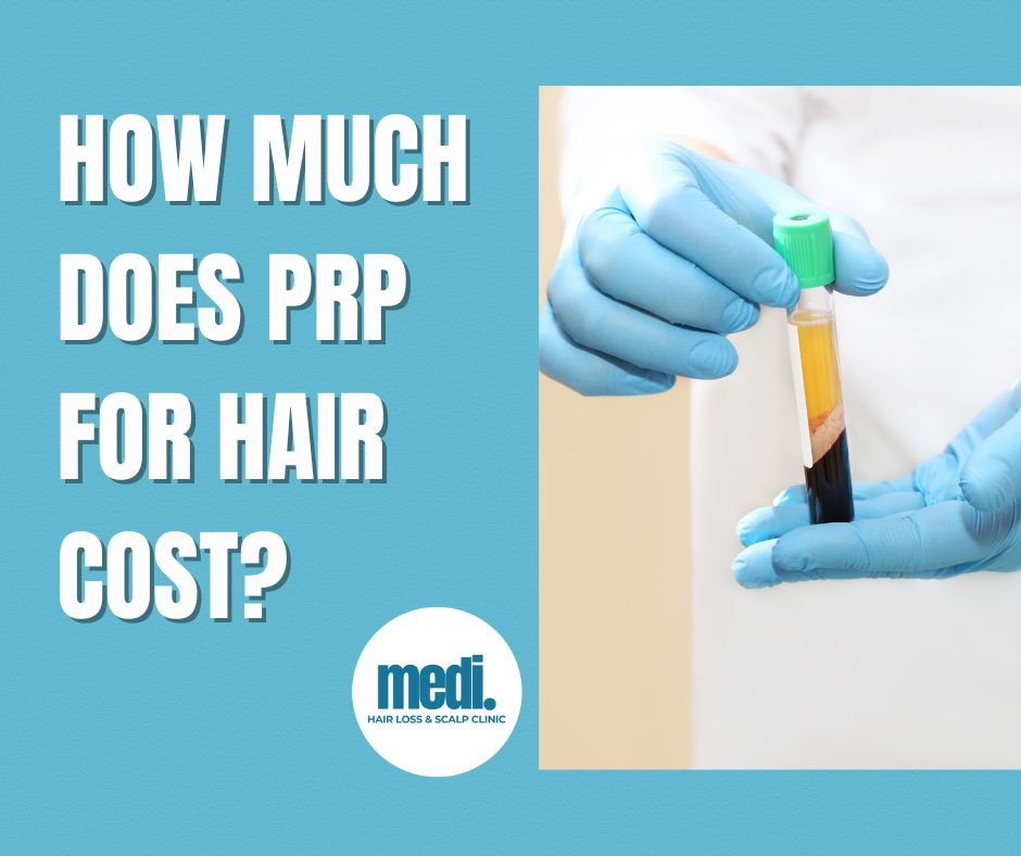 How Much Does PRP for Hair Cost? PRP Hair Restoration Cost - Toronto ...